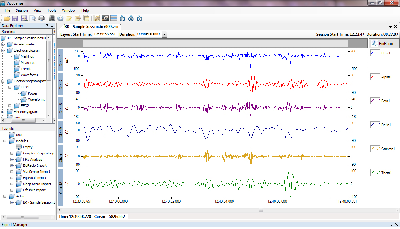 EEG - Great Lakes NeuroTechnologies